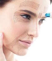 Plasma Fibroblasting Training – Rewind Skin Solutions